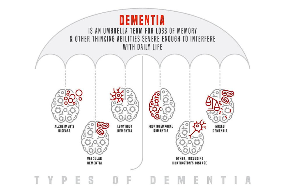 When to Be Concerned About Memory Loss: 3 Essential Steps to Take - Dr ...